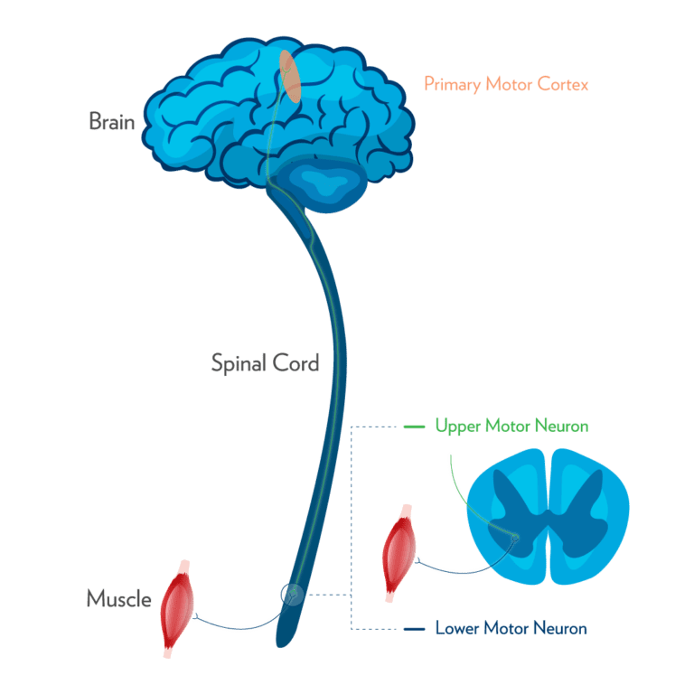 Verita Neuro - Defining Spasticity - Spasticity After Spinal Cord Injury