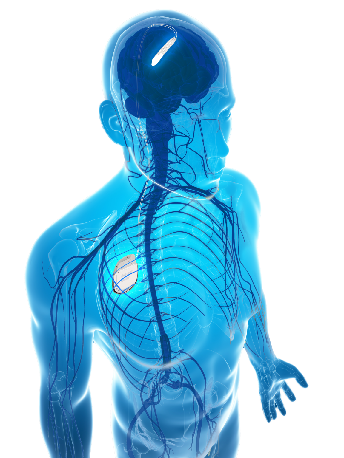 Understanding the Neuralink Brain Chip | A Brain-Computer Interface